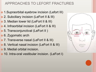 Lefort fractures | PPT