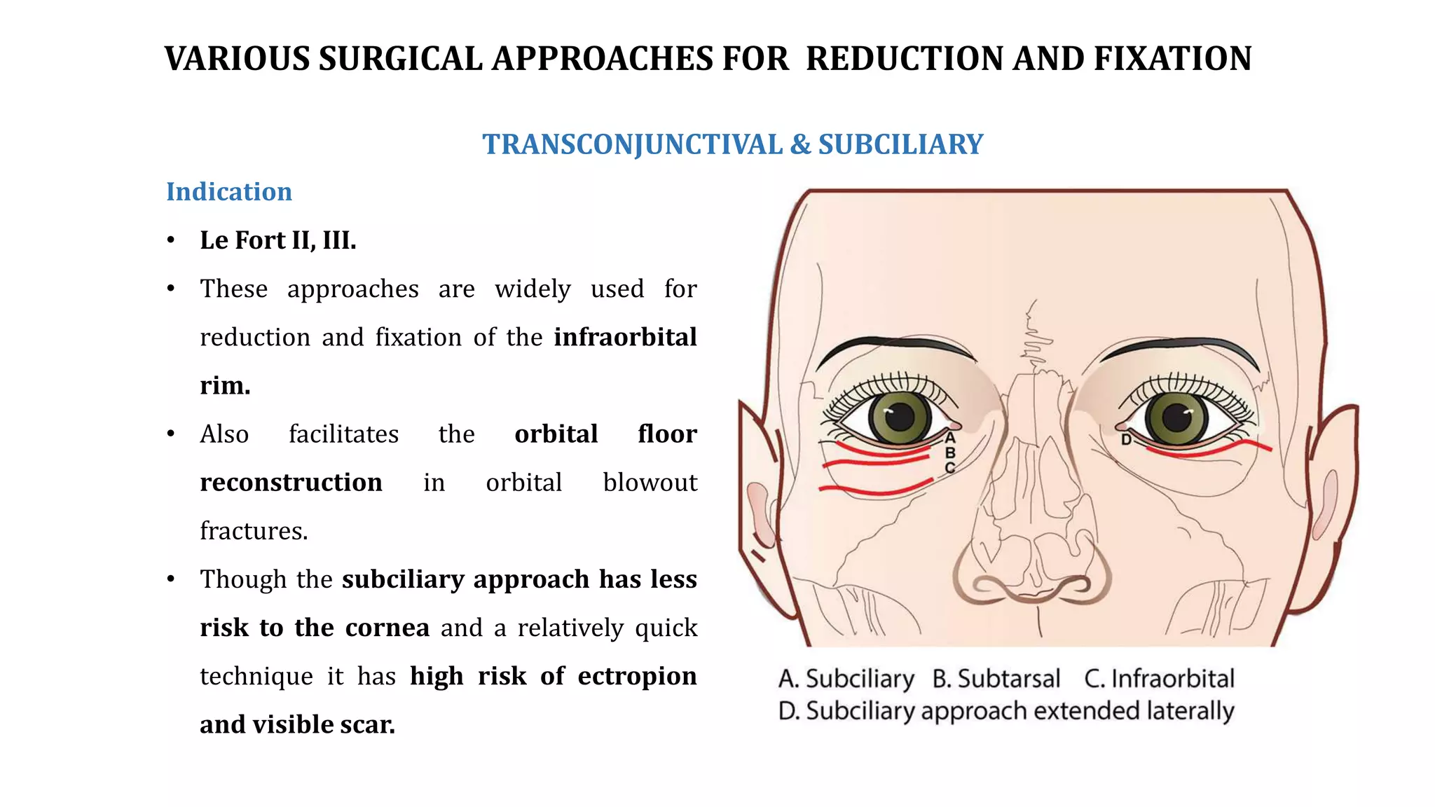 LEFORT FRACTURES.pptx