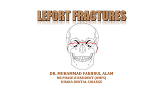 LEFORT FRACTURES.pptx