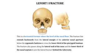 LEFORT FRACTURES.pptx