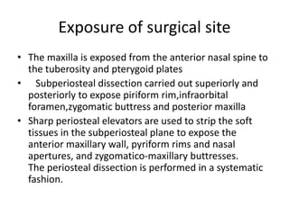 Le fort i maxillary osteotomy | PPTX