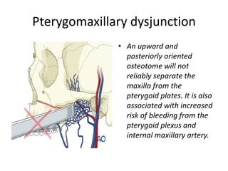 Le fort i maxillary osteotomy | PPTX