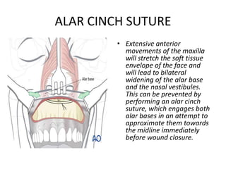 New bone-borne appliance: Facegenics Maxillary Expander (FME) installed ...