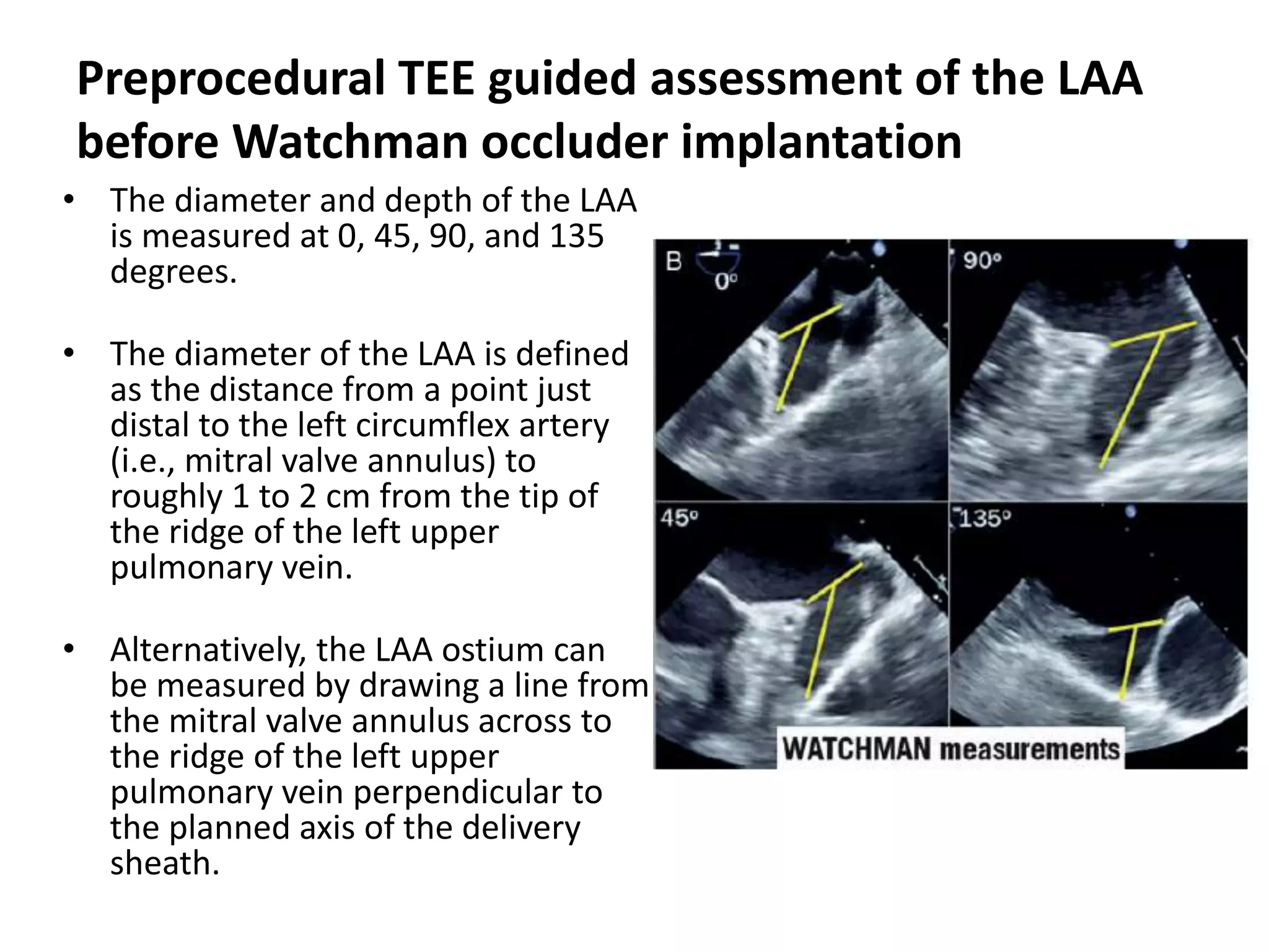 Left atrial appendage closure | PPTX