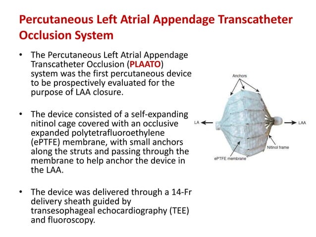 Left atrial appendage closure | PPTX
