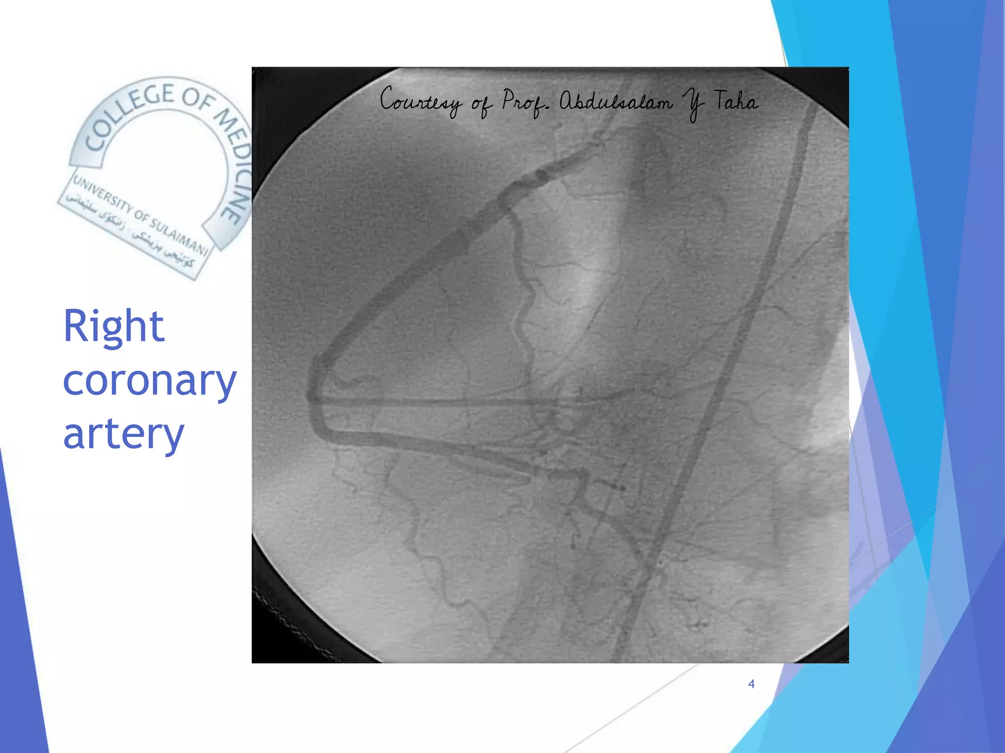 Left Common Iliac Artery Occlusion.pdf | Free Download