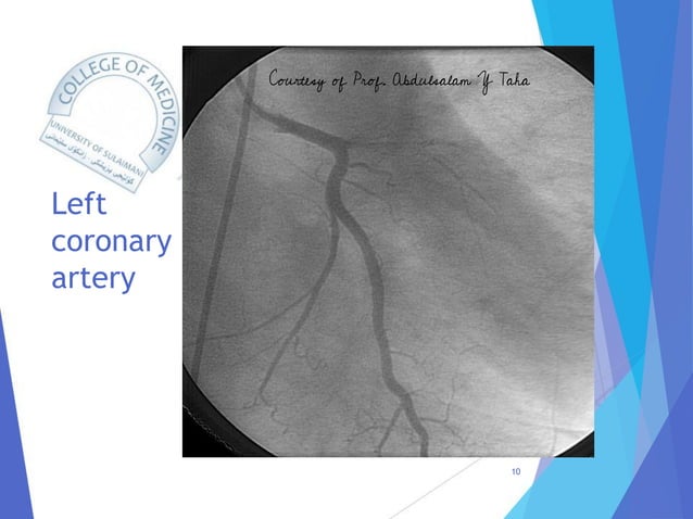 Left Common Iliac Artery Occlusion.pdf