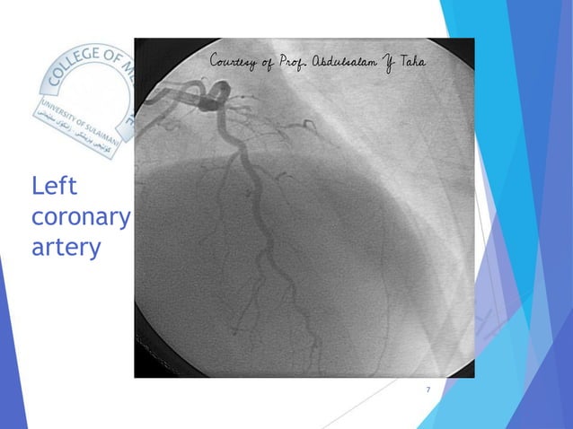Left Common Iliac Artery Occlusion.pdf | Free Download