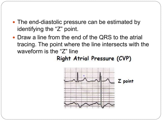 Left heart catheterization dr. nazmun ara | PPTX