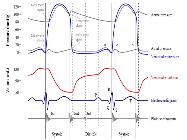 Left heart catheterization dr. nazmun ara | PPT