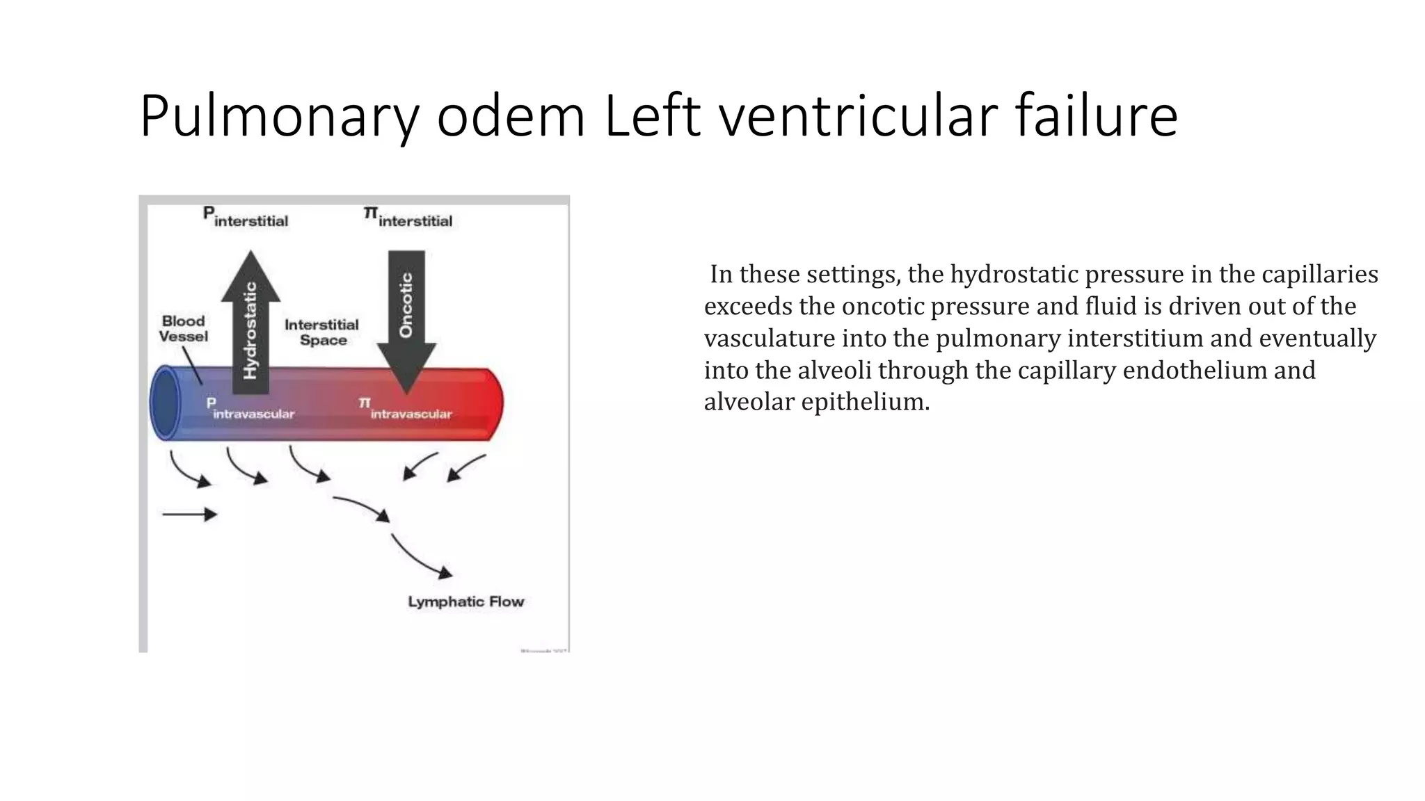 Left heart failure.pptx | Heart and Cardiovascular Diseases | Diseases ...