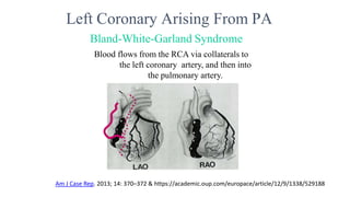 Left main disease final | PPTX