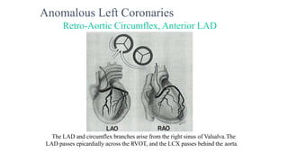 Left main disease final | PPTX