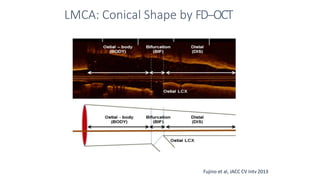 Left main disease final | PPTX | Heart and Cardiovascular Diseases ...