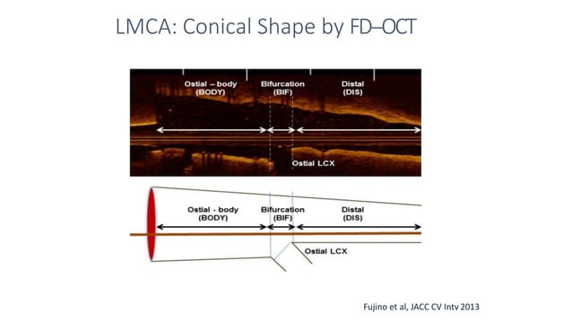 Left main disease final | PPT