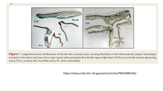 Left main disease final | PPTX | Heart and Cardiovascular Diseases ...