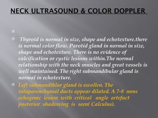 LEFT SUBMANDIBULAR SIALOTHISIS WITH SIALADENITIS | PPTX