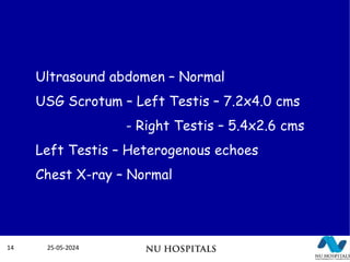 left testicular swelling of the left testis urology ppt | PPT