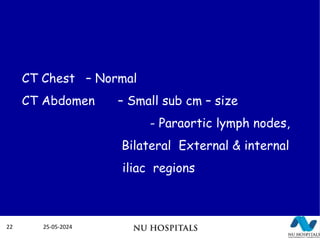 left testicular swelling of the left testis urology ppt | PPT