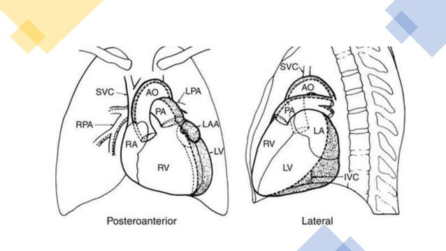 pathophysiology of Left to right shunt | PPTX | Heart and ...