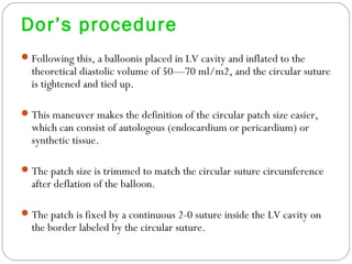 Leftventricularaneurysm 130208122724-phpapp02 | PPT