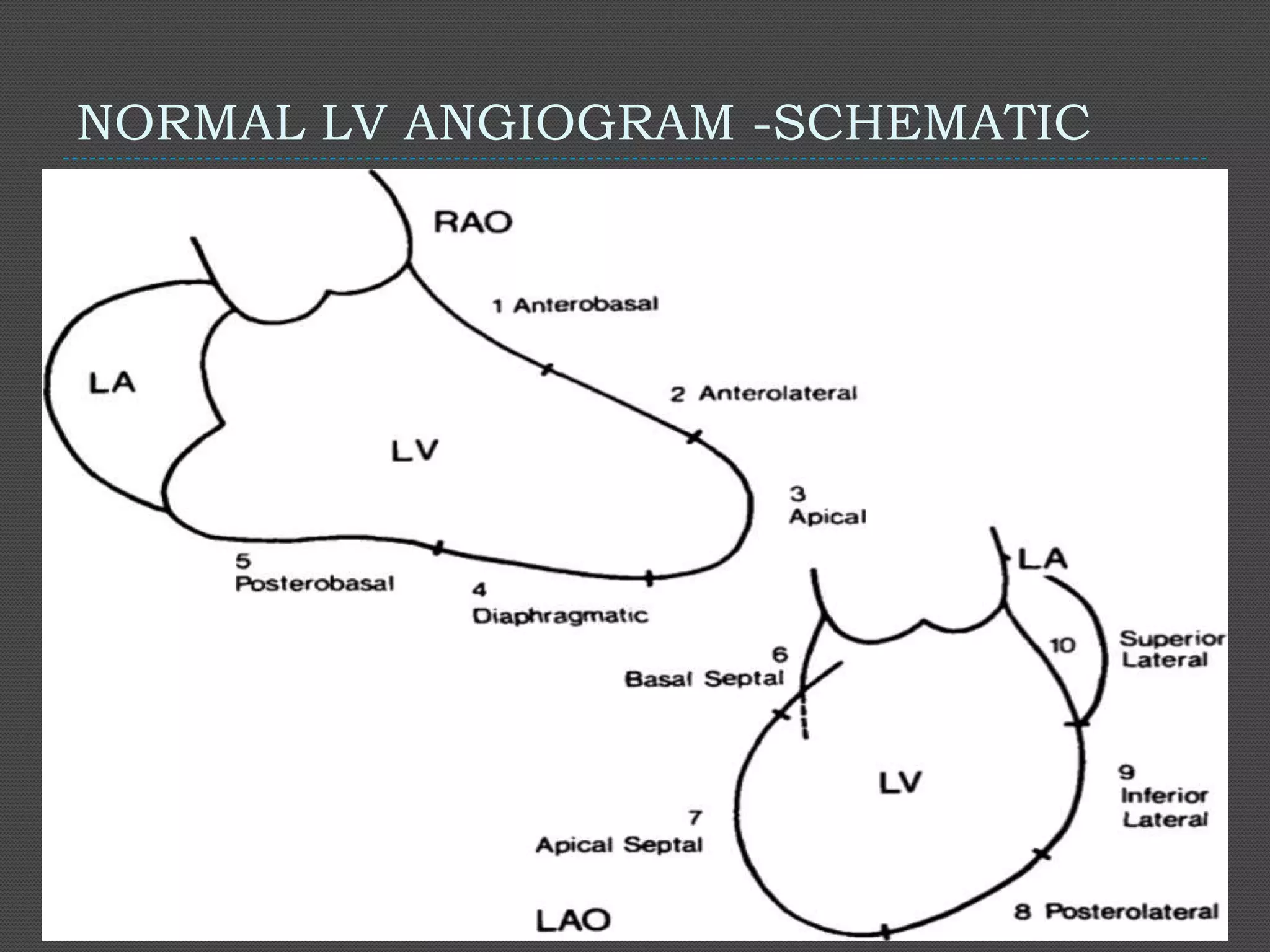 Left ventricular angiogram (1) | PPTX