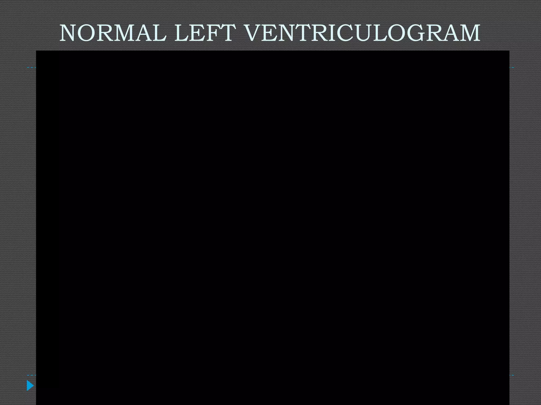 Left ventricular angiogram (1) | PPTX