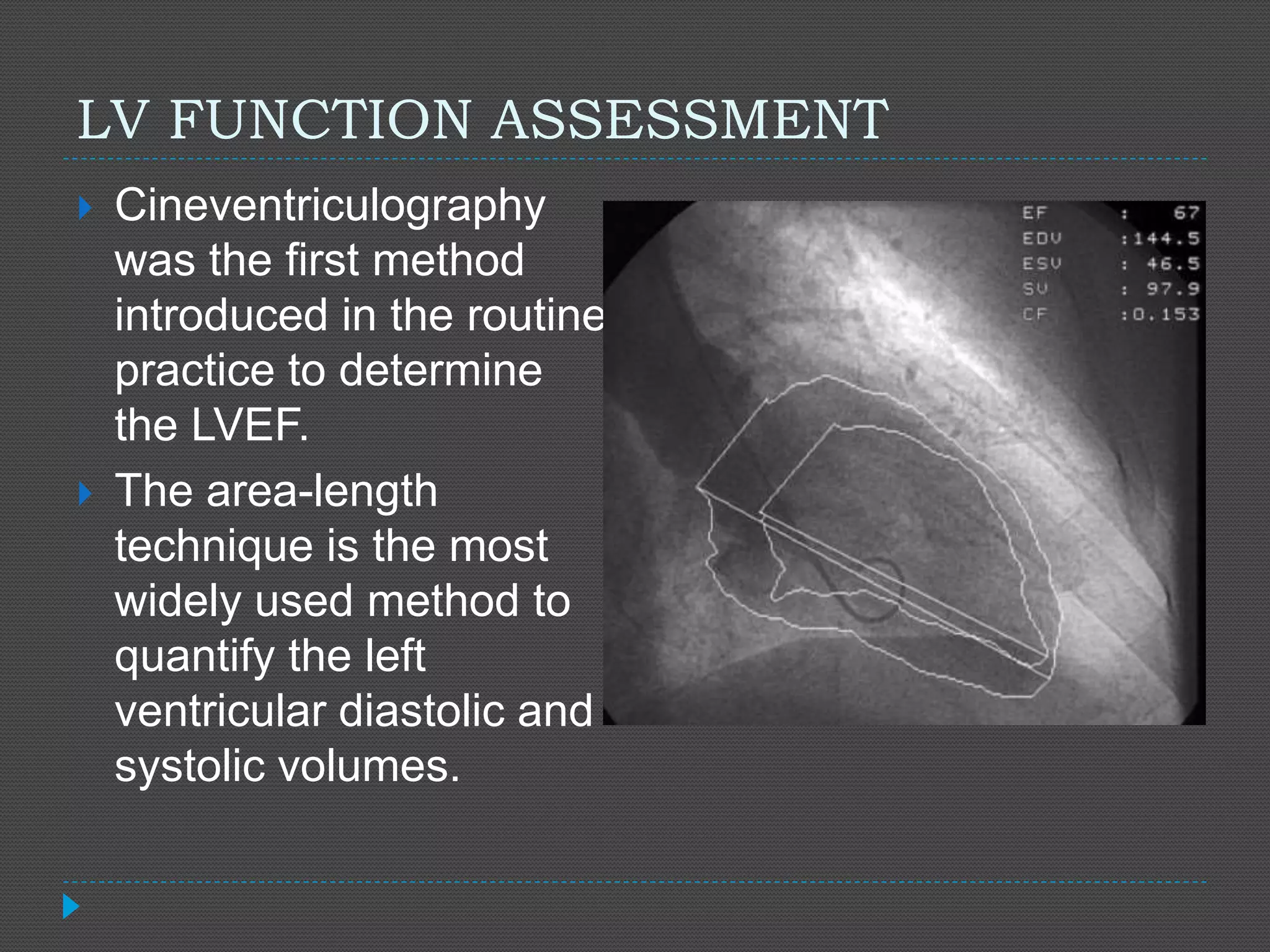 Left ventricular angiogram (1) | PPTX