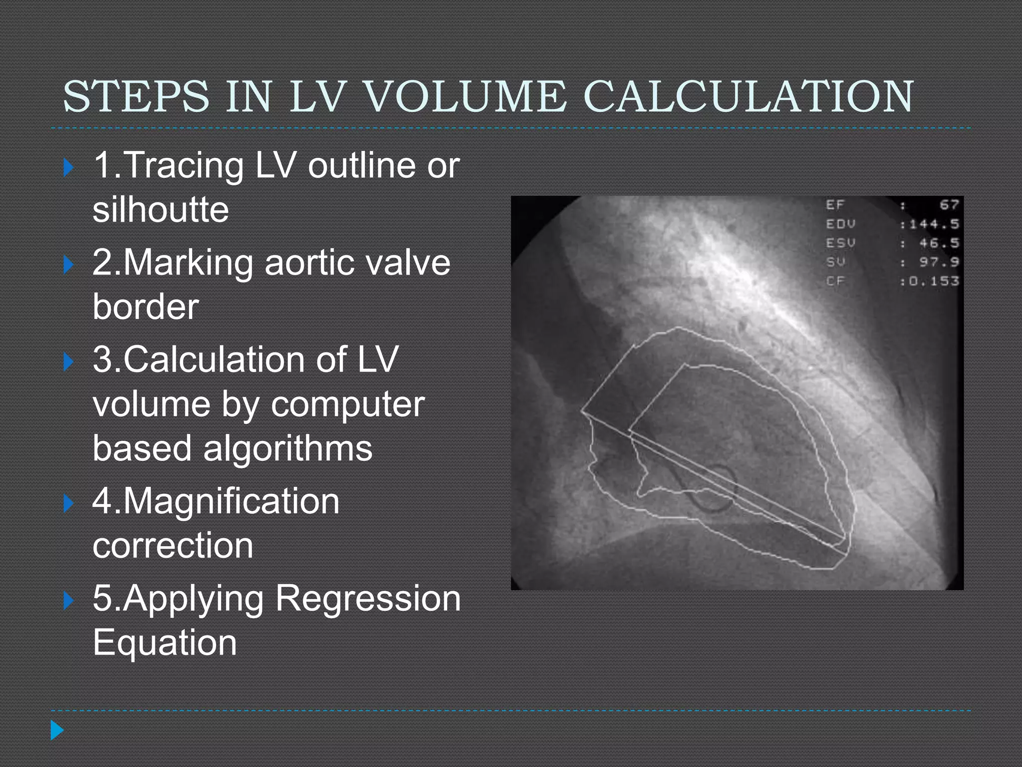 Left ventricular angiogram (1) | PPTX