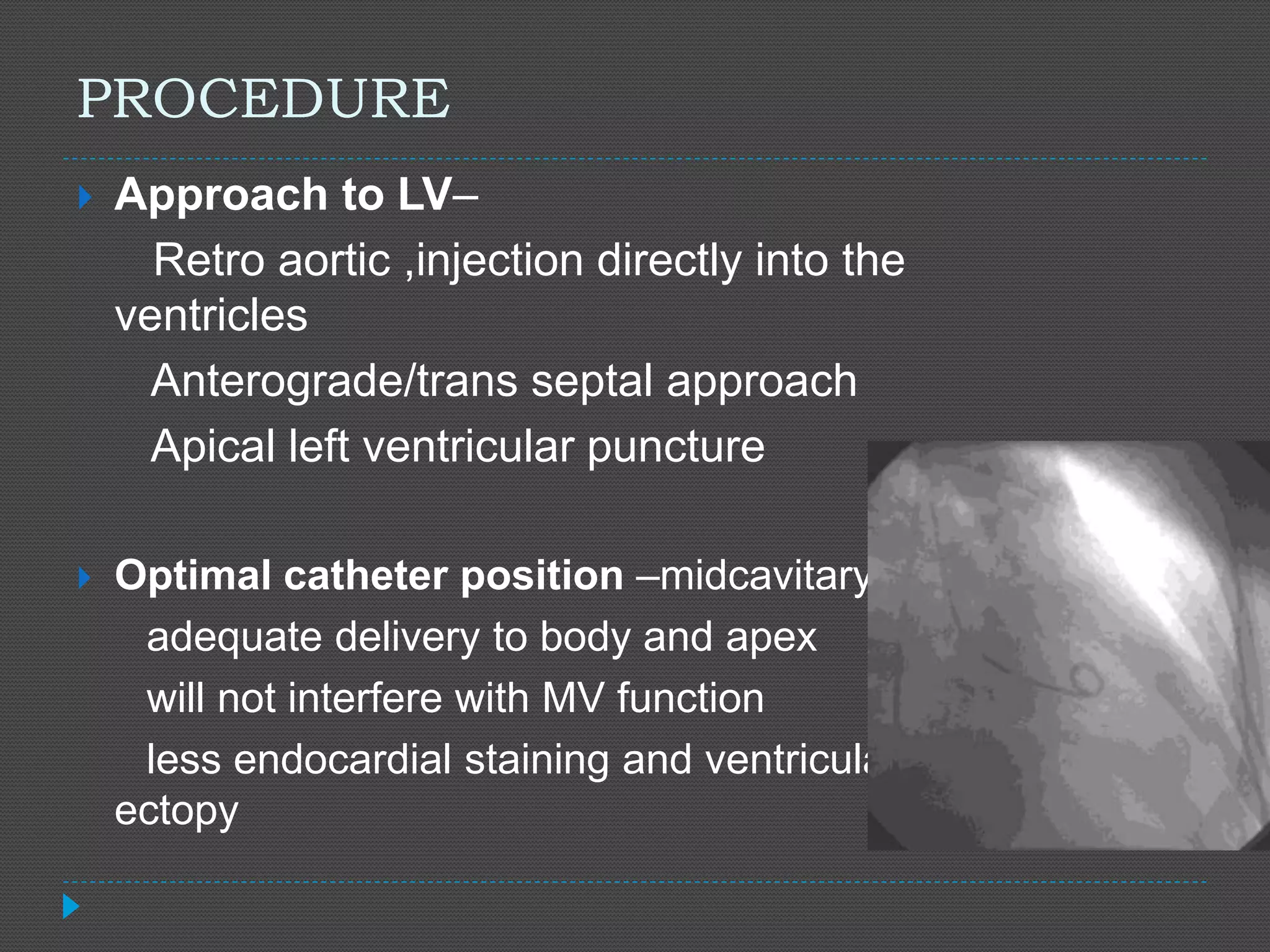 Left ventricular angiogram (1) | PPTX