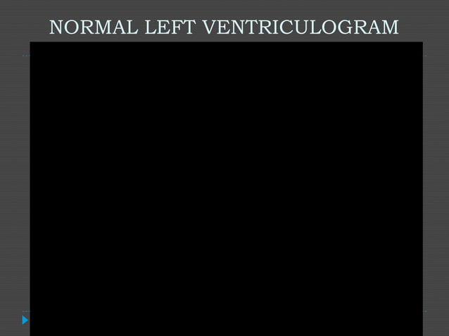 Left ventricular angiogram (1) | PPTX | Heart and Cardiovascular ...