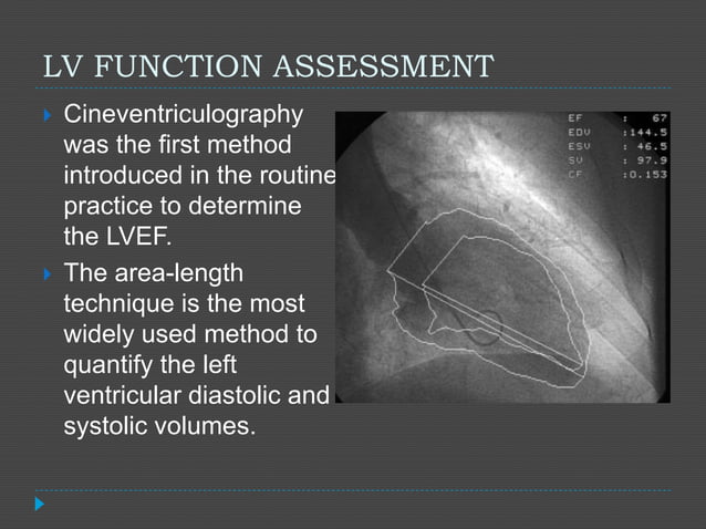 Left ventricular angiogram (1) | PPTX | Heart and Cardiovascular ...