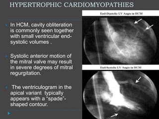 Left ventricular angiogram (1) | PPTX