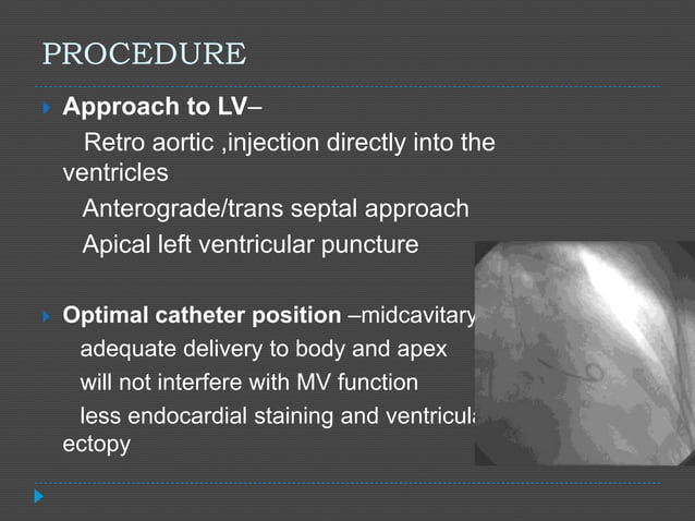 Left ventricular angiogram (1) | PPTX | Heart and Cardiovascular ...