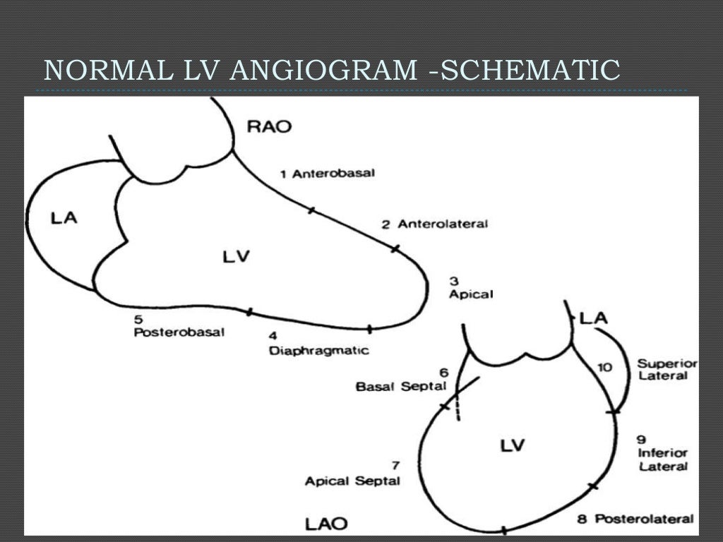 Left ventricular angiogram (1)