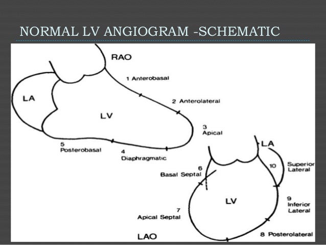 Left ventricular angiogram (1)