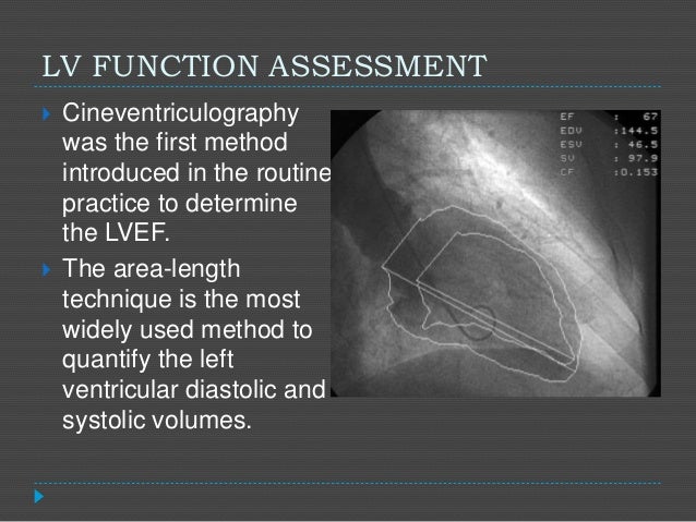 Left ventricular angiogram (1)