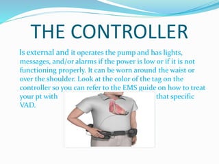 Left ventricular assist device | PPTX