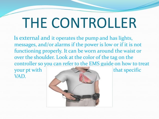 Left ventricular assist device | PPTX | First Aid | Injuries