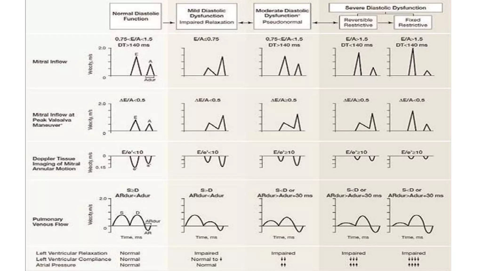 Left ventricular diastolic dysfunction in echocardiography | PPTX