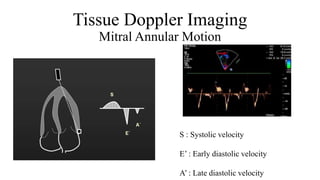 Left ventricular diastolic dysfunction in echocardiography | PPTX