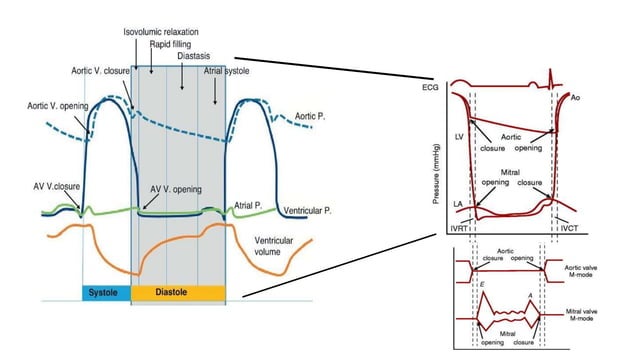 Left ventricular diastolic dysfunction in echocardiography | PPTX ...