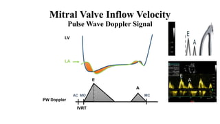 Left ventricular diastolic dysfunction in echocardiography | PPTX