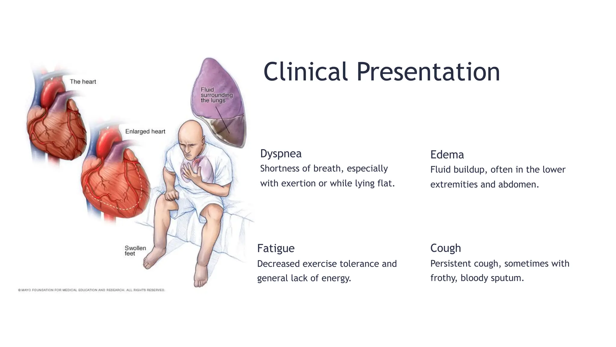 Presentation on left ventricular failure ppt.pptx.pdf