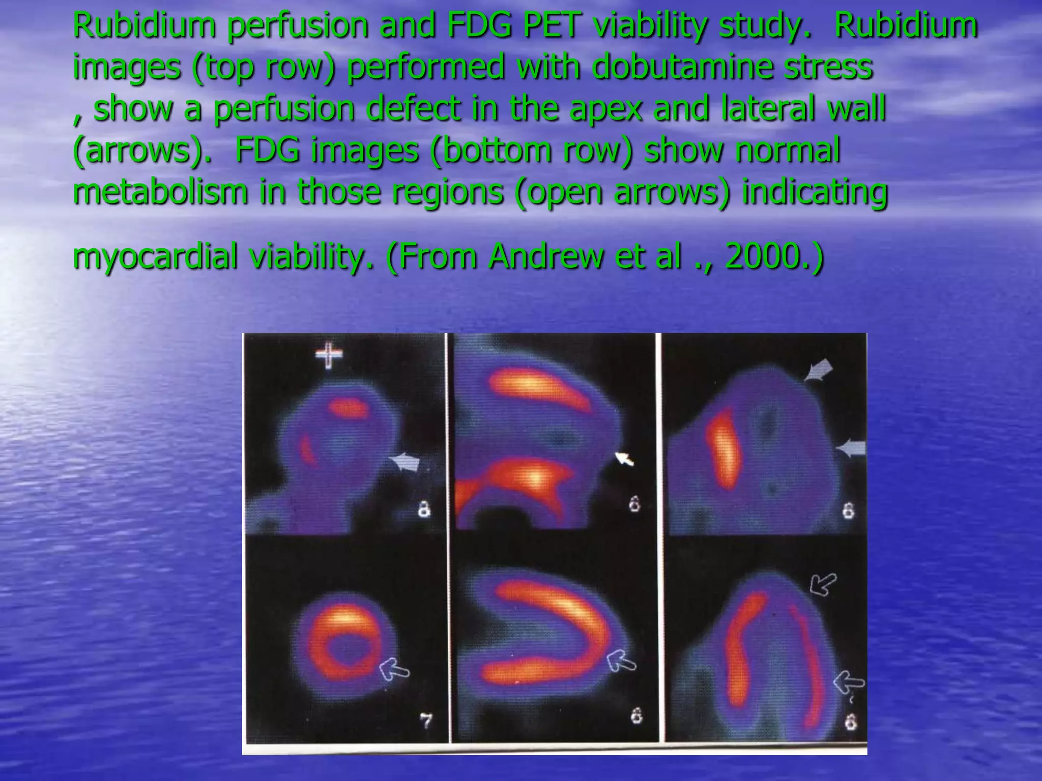 Left ventricular function evaluation | PPT
