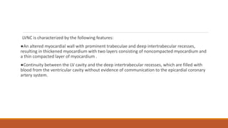 Left ventricular noncompaction | PPT