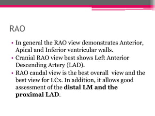 LEFT VENTRICULOGRAPHY.pptx