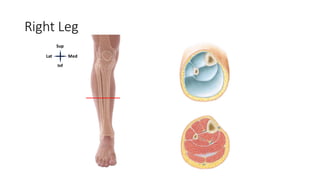 The musculature,nerves,veins,arteries of leg | PDF