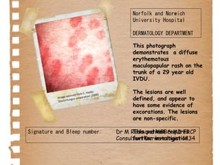 Legal Aspects of HIV | PPT