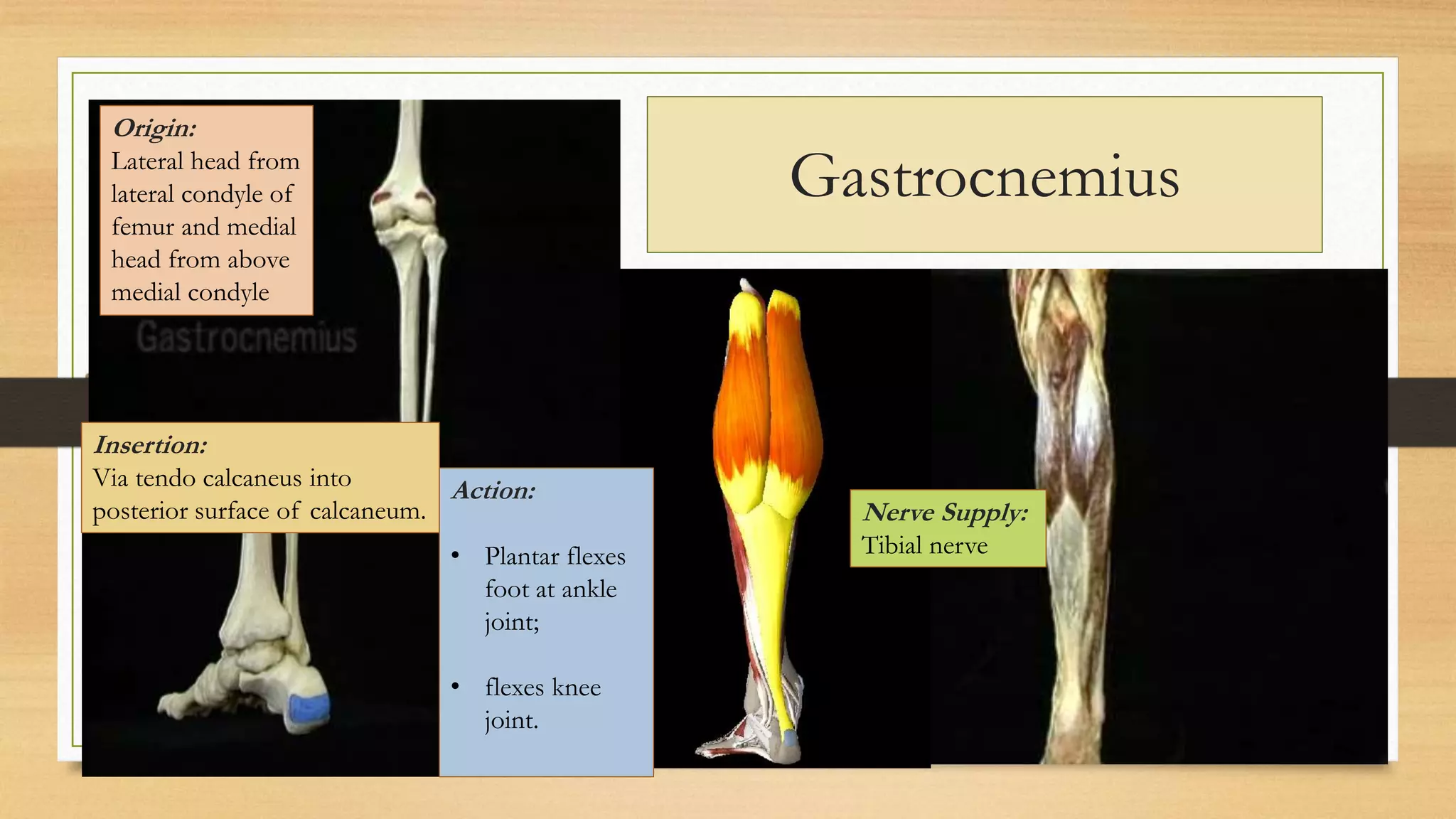 Leg: from anatomy to orthopedisc | PPTX